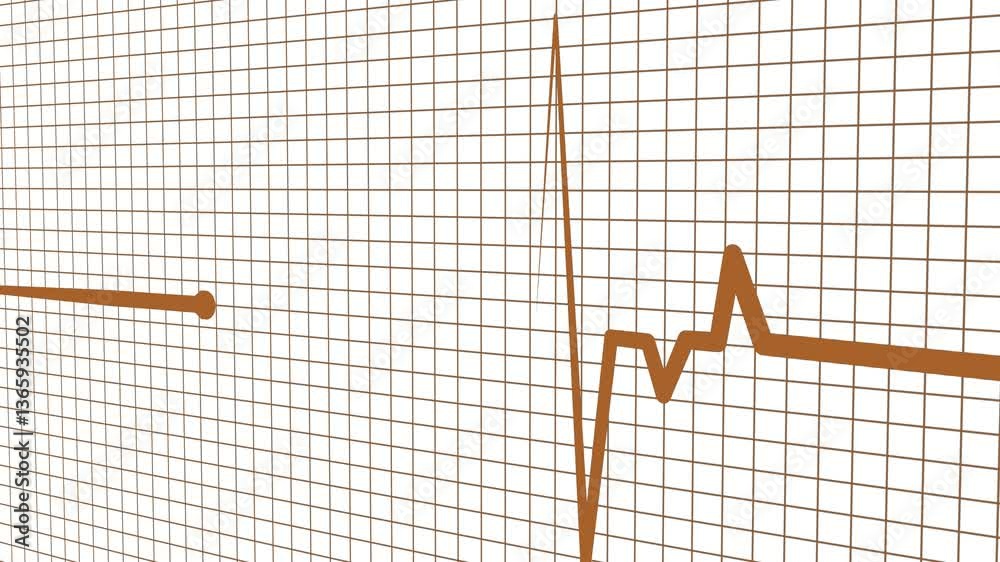 Electrocardiogram Heartbeat Line Graph Animation, A electrocardiogram ...