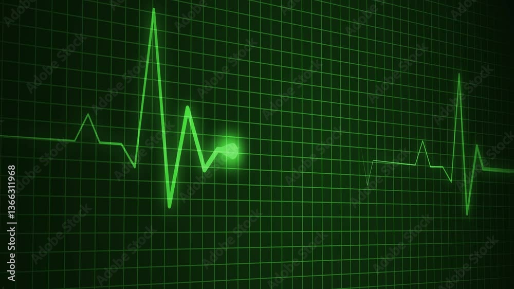 Digital ECG Heartbeat Display Animation, A digital electrocardiogram ...