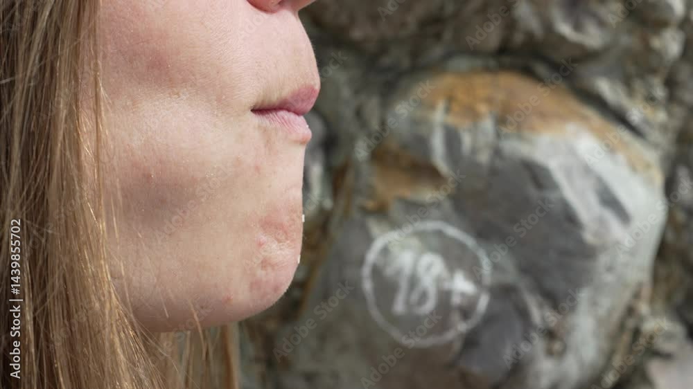 Face Skin Woman. Side view of a Woman with acne on her chin near rock ...