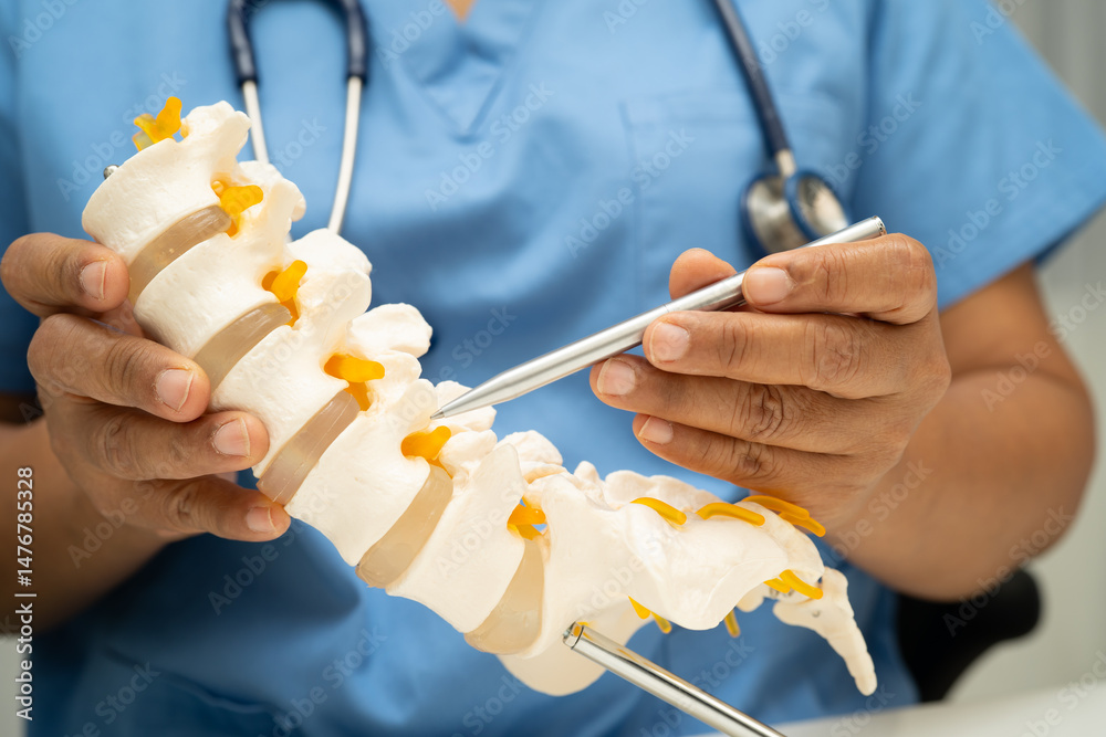 Póster Asian doctor holding spinal nerve and bone model, Lumbar spine ...