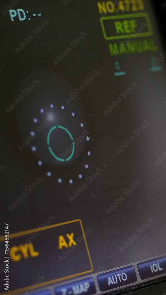 Auto-Ref-Keratometer display with an eye on it. the doctor controls the ...