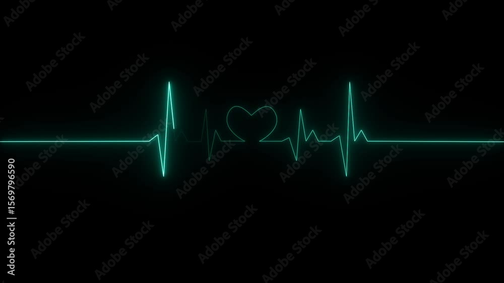 electrocardiogram (ECG or EKG) tracing, which visually represents the ...