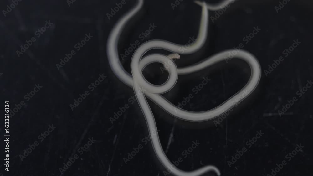 The nematodes (Nematoda), roundworms or eelworms constitute the phylum ...