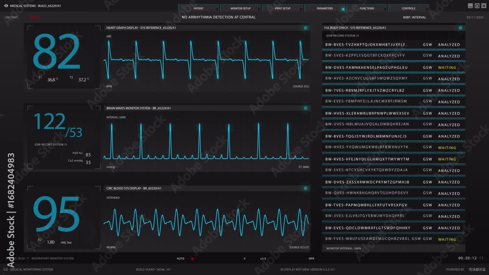 Dynamic Medical Monitoring System Displaying Vital Signs and Real-time ...