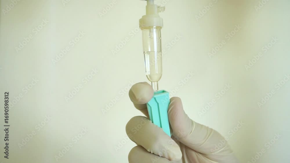 Medical personnel measuring IV drips. Set iv fluid intravenous drop ...