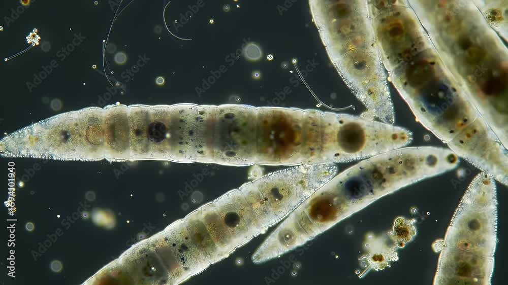 Microscopic View of Transparent Nematodes Swimming Freely in Dark ...