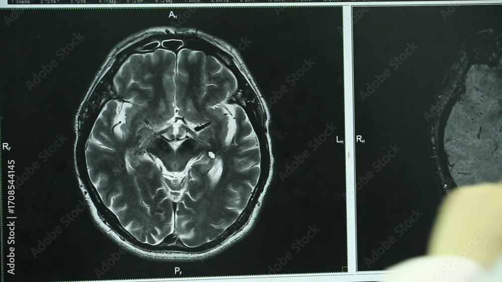 A detailed view of a chest CT scan displaying cross-sections of the ...