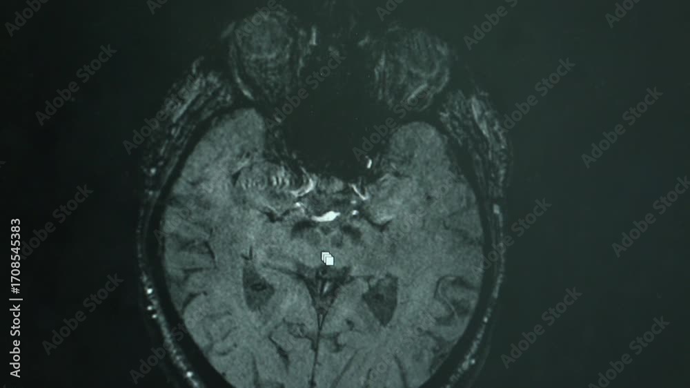 A detailed view of a chest CT scan displaying cross-sections of the ...