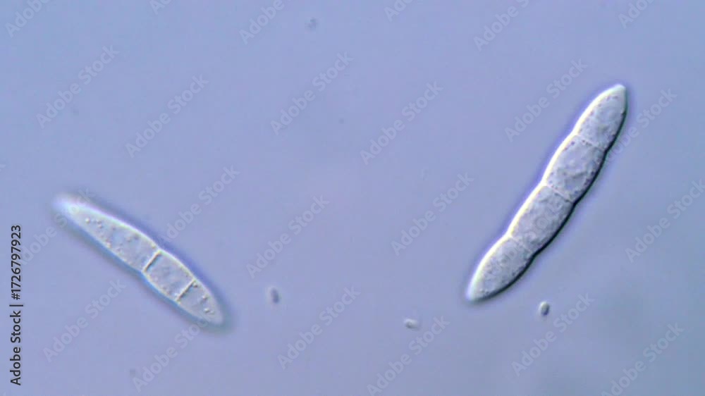 4K Microscopy of Fusarium Fungal spore, 1000x vídeo de Stock | Adobe Stock