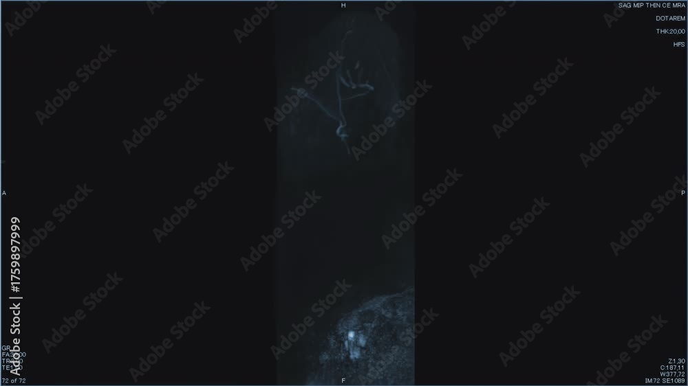 Magnetic resonance images of the head and neck, MRI of the brain, side ...