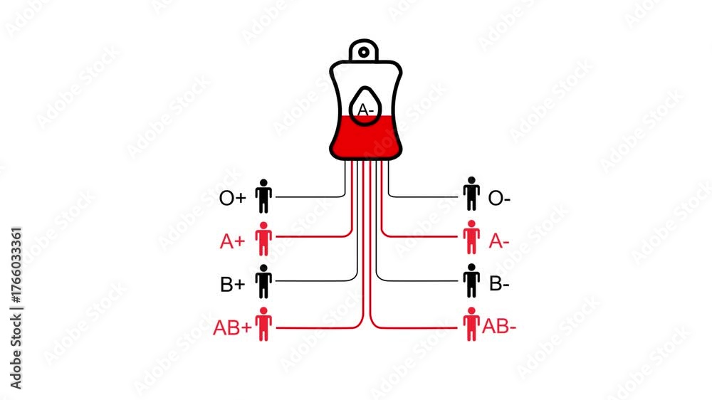 Blood type compatibility chart with A negative blood bag and compatible ...