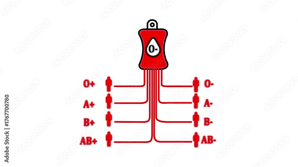 Blood Donation Compatibility Chart Showing O- Blood Bag and Recipient ...