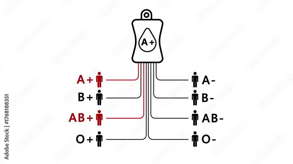 Blood Group Compatibility Charts Video. Donor & Recipient Diagrams for ...