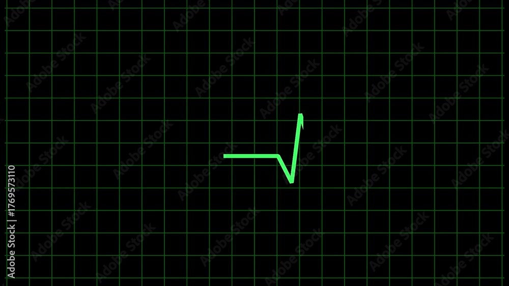 ECG cardiograph looping animation. Heartbeat flatline green line ...