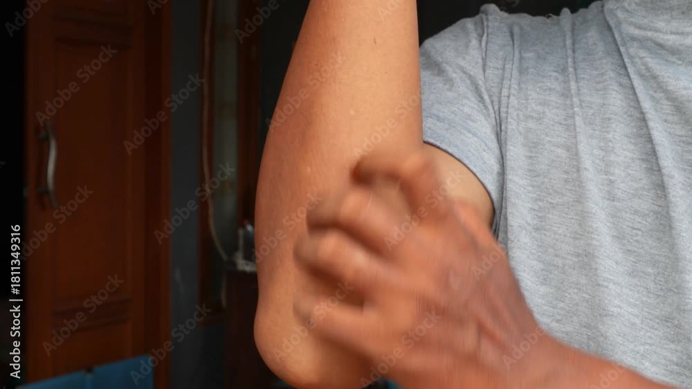 Young asian man itching and scratching on arm from itchy dry skin ...