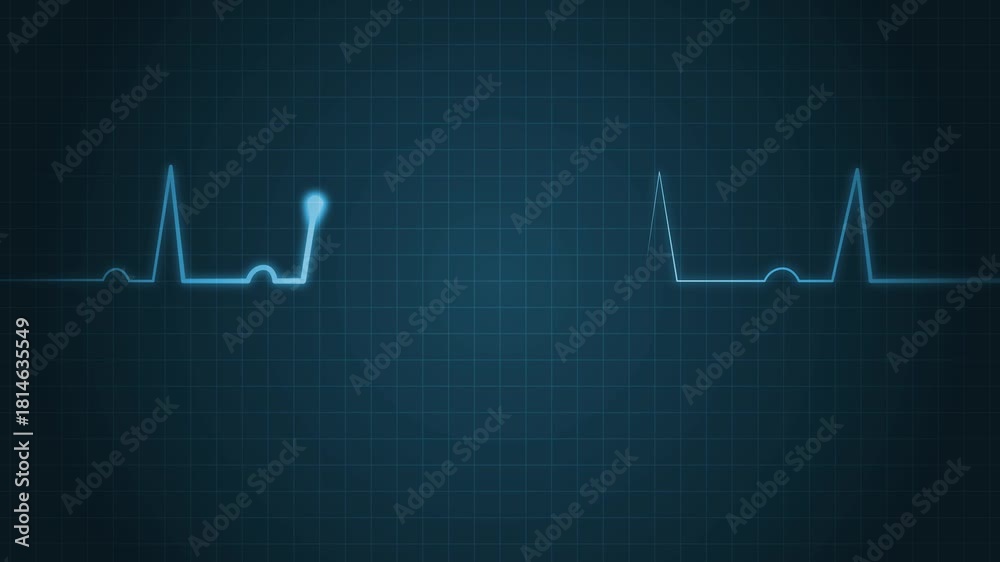 Heartbeat Line Wave Signal Animation with Animated ECG Pulse and ...
