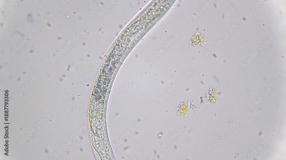 Immobile nematode in a bottom-to-top panoramic view with clearly ...