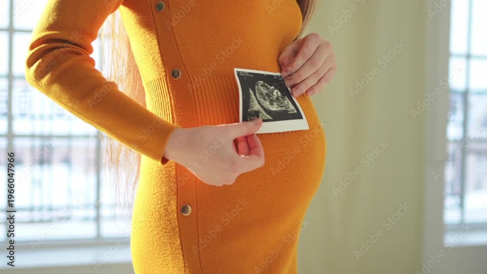 Prenatal ultrasound screening. Pregnant woman hands holding sonogram ...